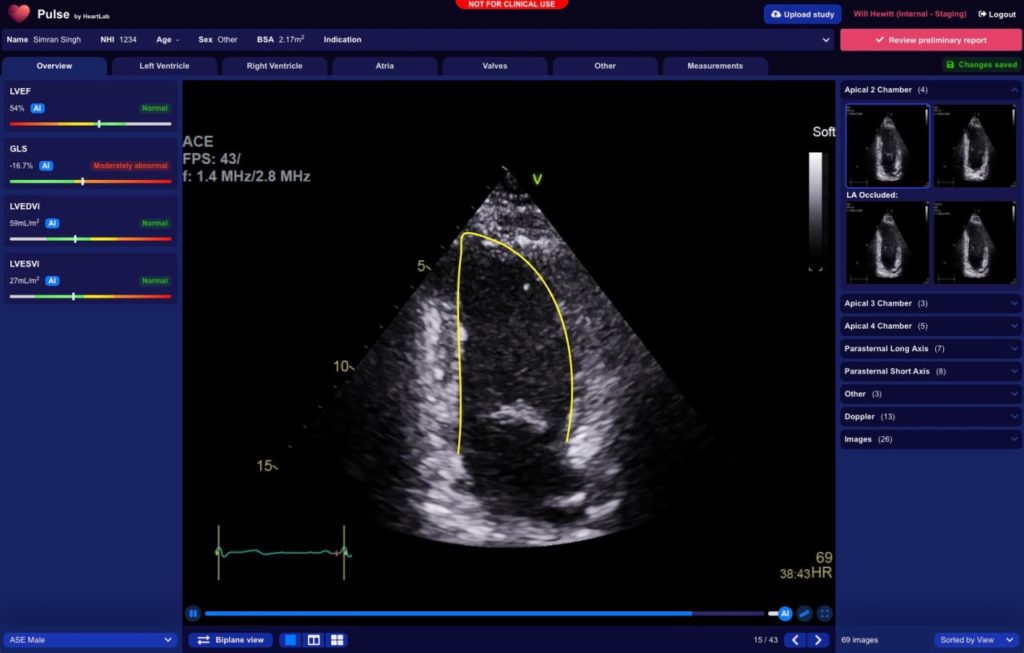 HeartLab: Revolutionizing Cardiology with AI-Powered Solutions fxis.ai